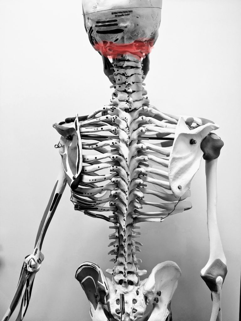 Atlas und Axis - Beschwerdebilder - Chiropraktoren Neuer Weg